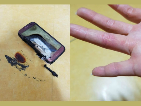 Alleged Samsung Galaxy S7 bursts into flames leaving blisters on user's ...
