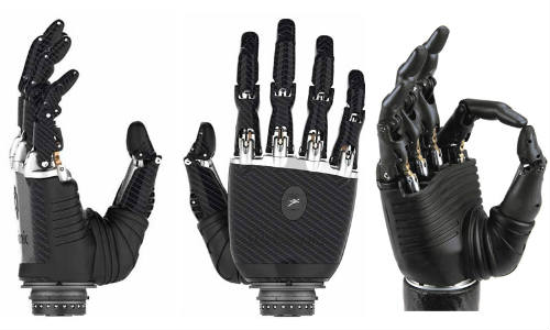terminator-arm-is-worlds-most-advanced-prosthetic |ಏನಿದು ಟರ್ಮಿನೇಟರ್‌ ಕೈ ...