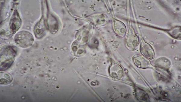 ஆக்ஸிஜன் இல்லாமல் உயிர் வாழும் உலகின் முதல் உயிரினம் கண்டுபிடிப்பு ...