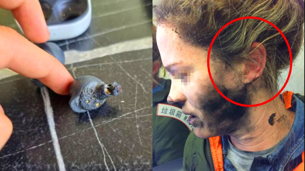 பெண்ணின் காதில் வெடித்து சிதறிய TWS இயர்பட்ஸ்.. எந்த பிராண்ட்? என்ன ...