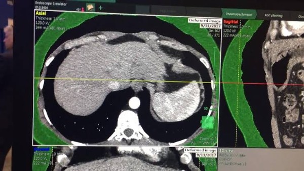 గిన్నిస్ రికార్డు సృష్టించిన OV6948 చిన్నకెమెరా సెన్సార్‌ |OmniVision ...